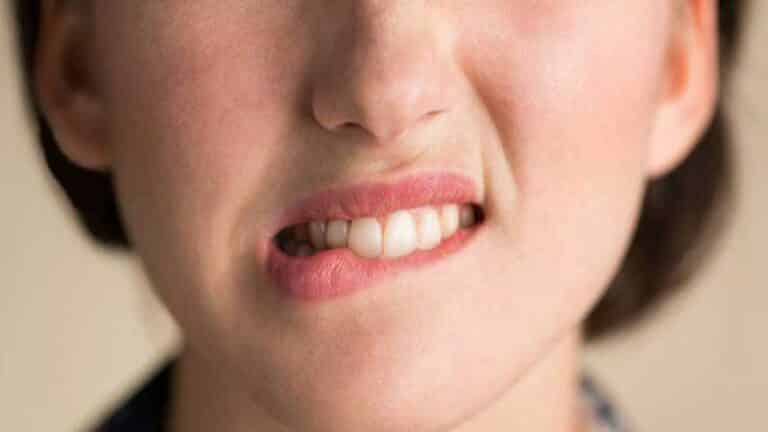 El signo de Russell como huella de la anorexia